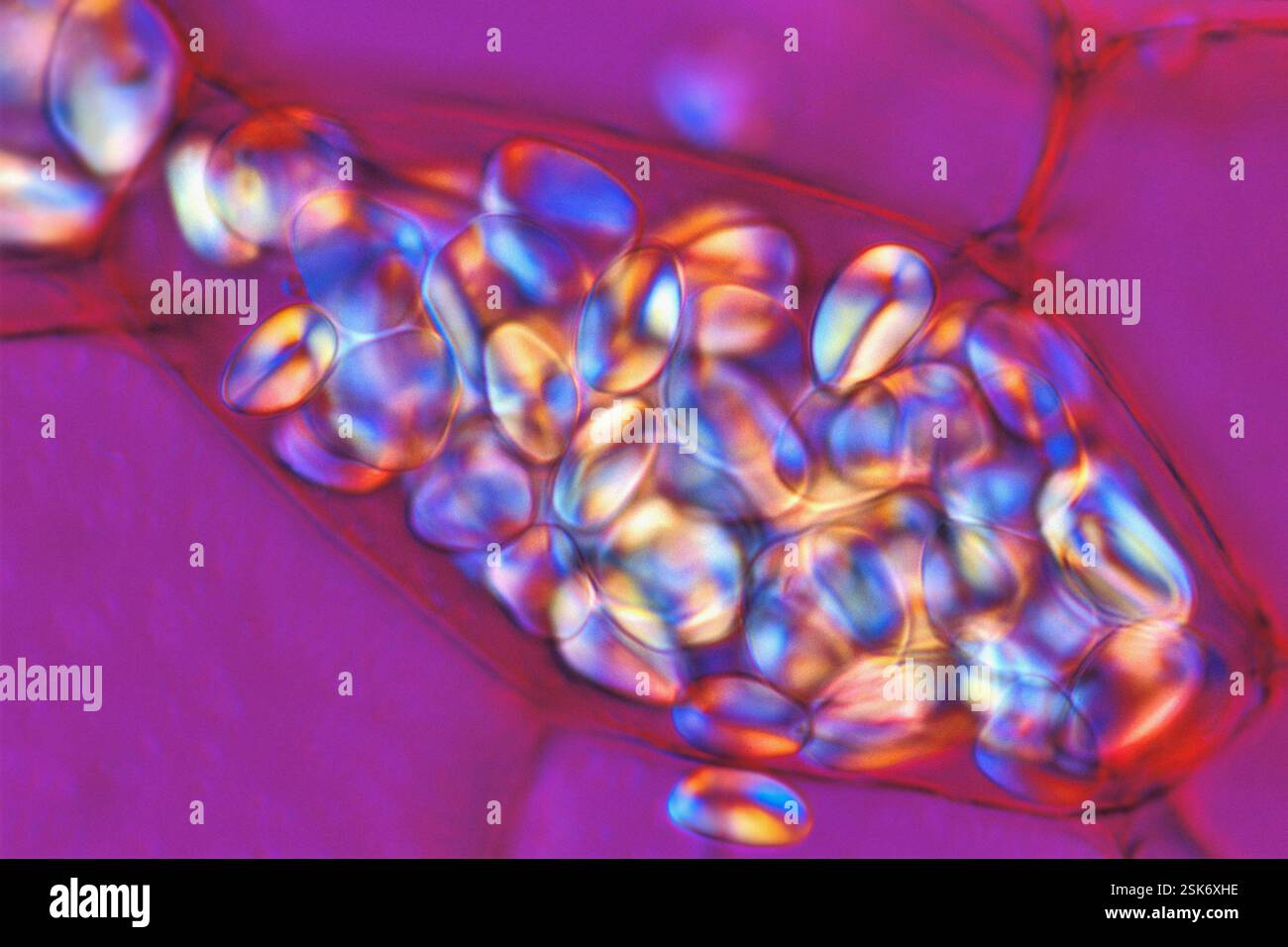 Starch grains. Polarised light micrograph of a section through tissue ...