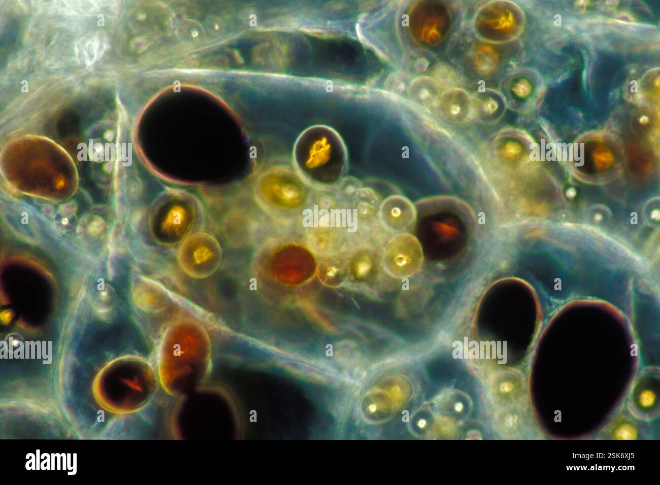 Potato starch grains. Light micrograph of a section through a potato ...