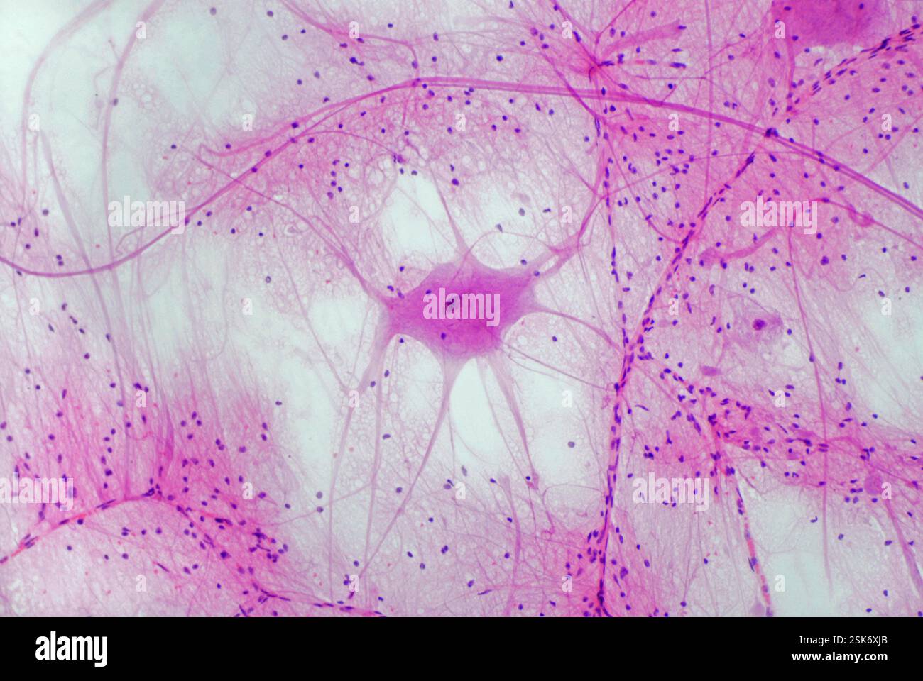 Multipolar neurons. Light micrograph of a cluster of multipolar nerve ...