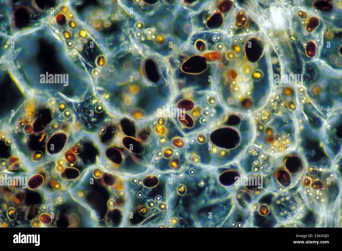 Potato starch grains. Light micrograph of a section through a potato ...