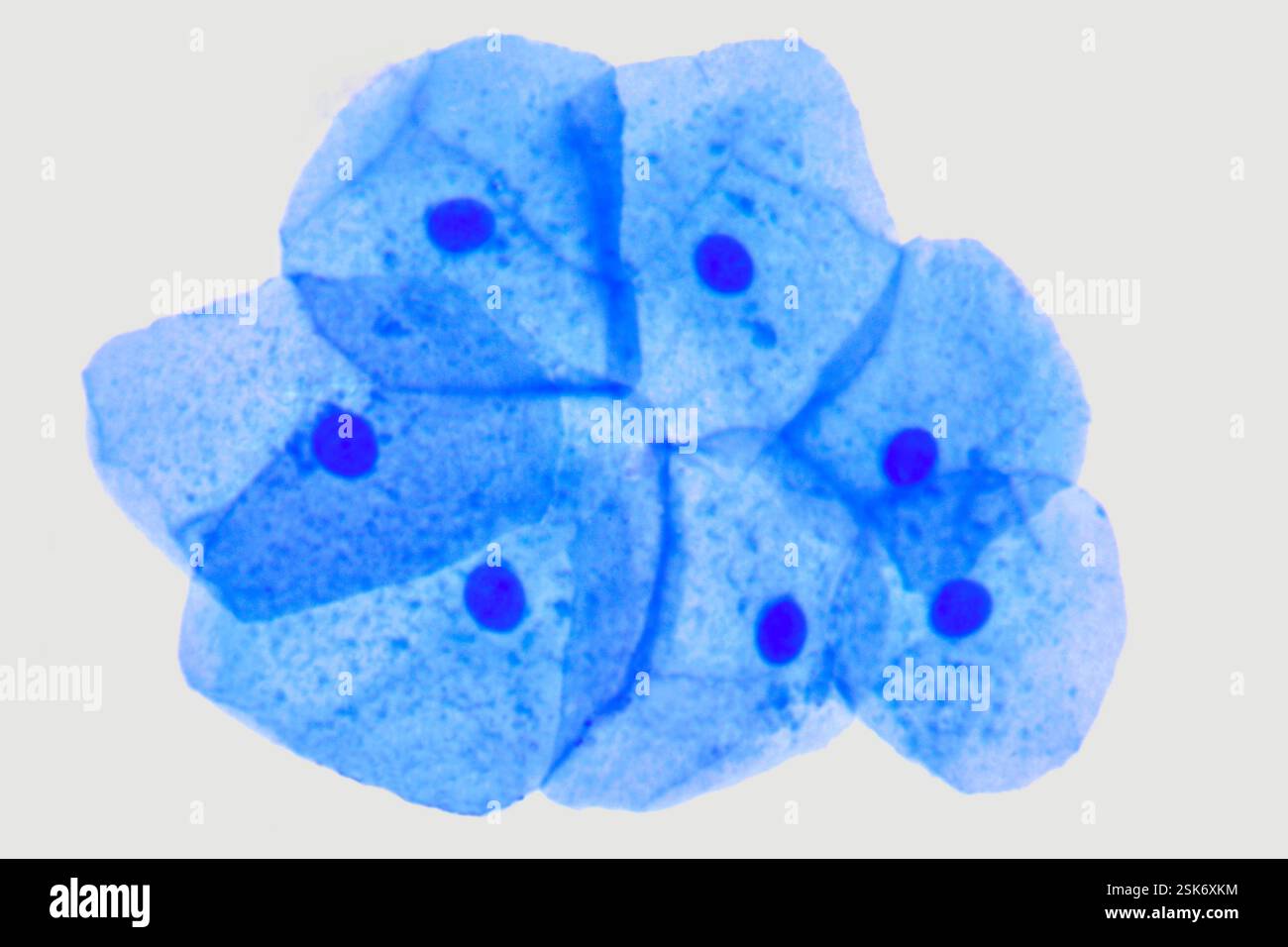 Mouth skin cells. Light micrograph of a section through normal ...