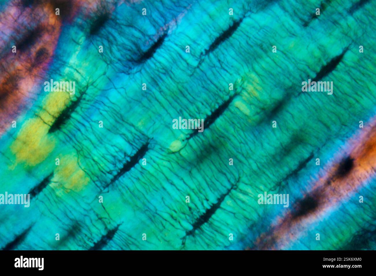 Osteocyte bone cells. Analysed polarised light micrograph of a ...