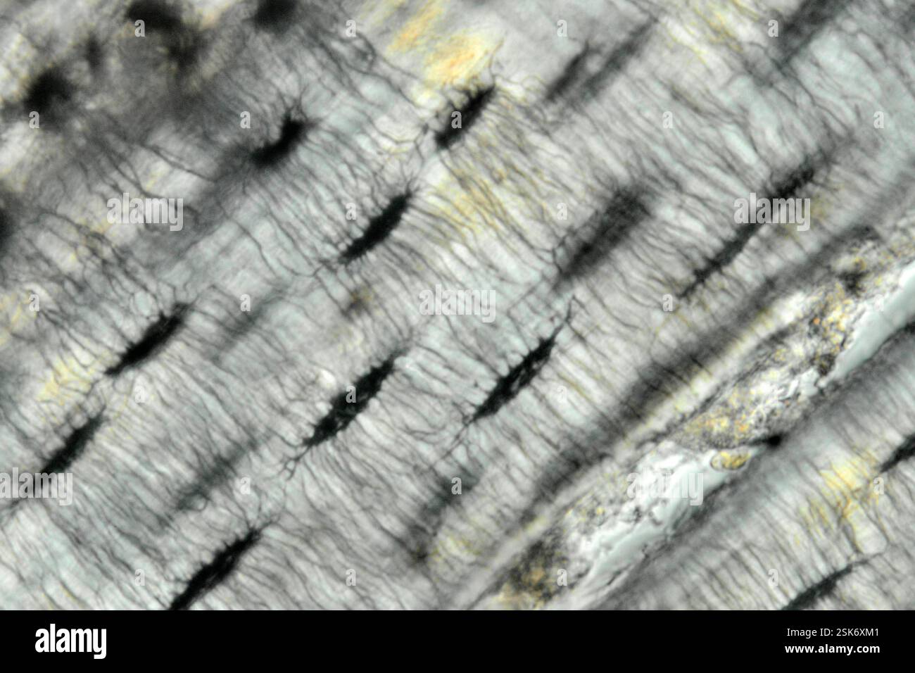 Osteocyte bone cells. Light micrograph of a transverse section through ...