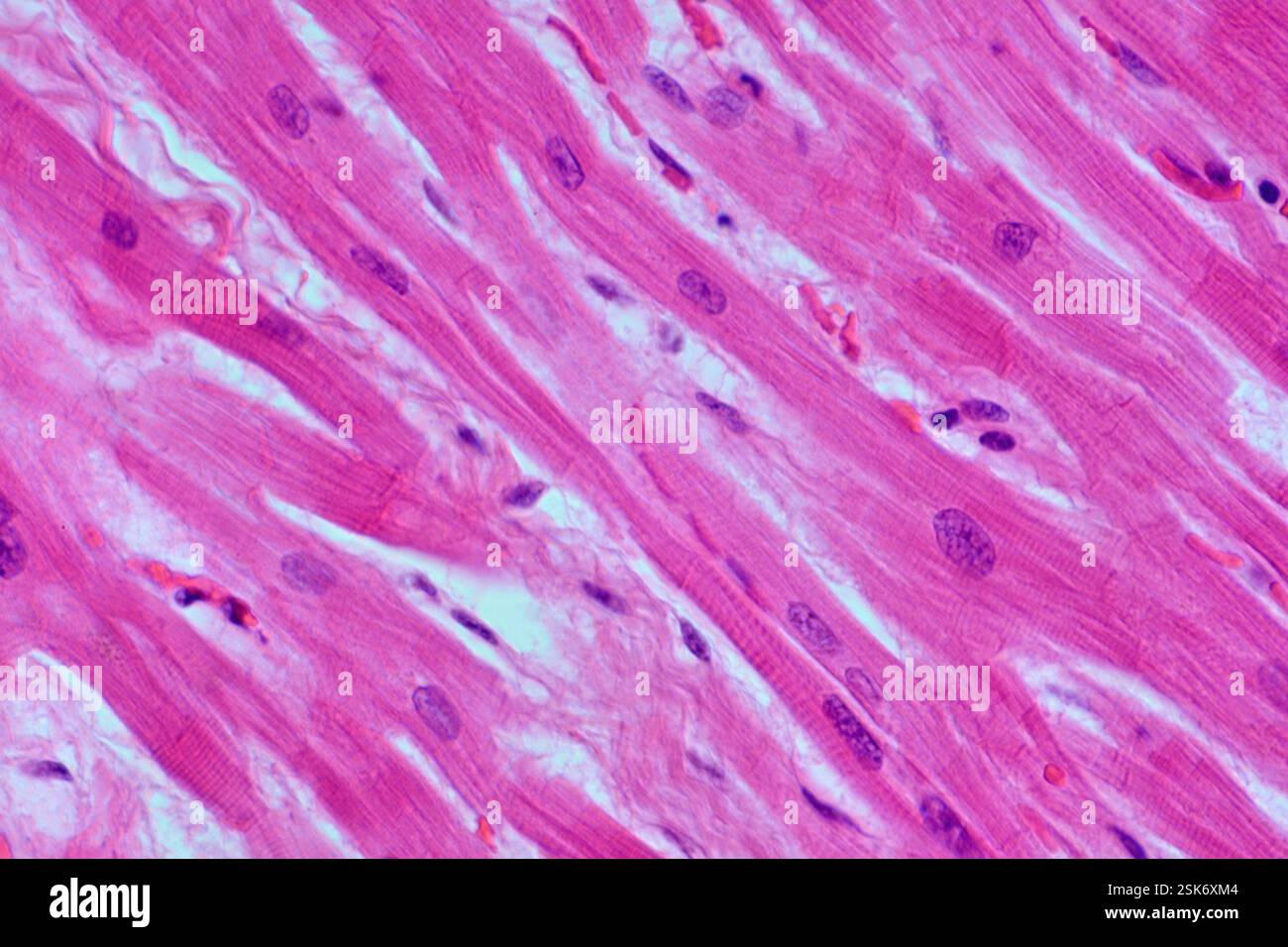 Heart muscle. Light micrograph of a section through the muscle tissue ...