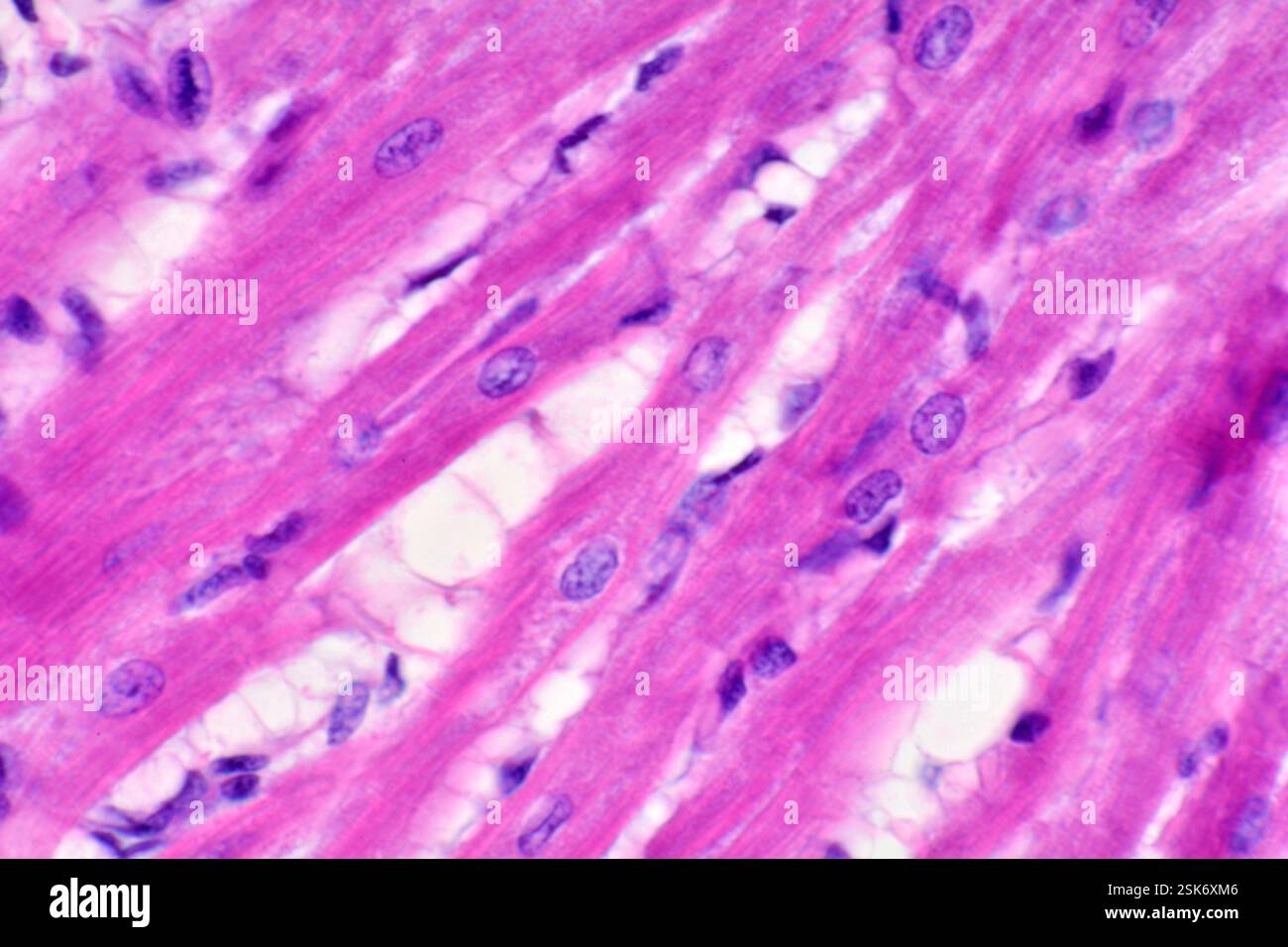 Heart muscle. Light micrograph of a section through the muscle tissue ...