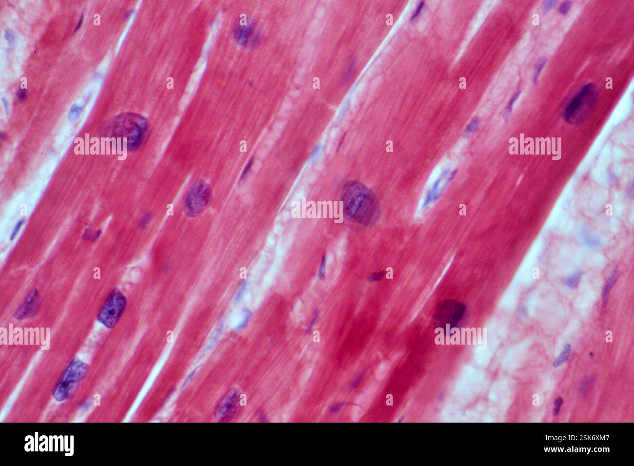 Heart muscle. Light micrograph of a section through the muscle tissue ...