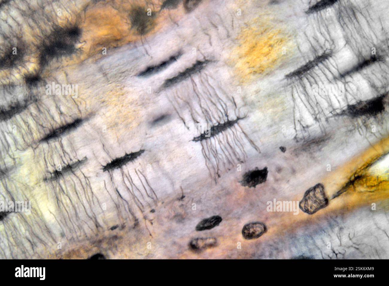 Osteocyte bone cells. Non-analysed polarised light micrograph of a ...