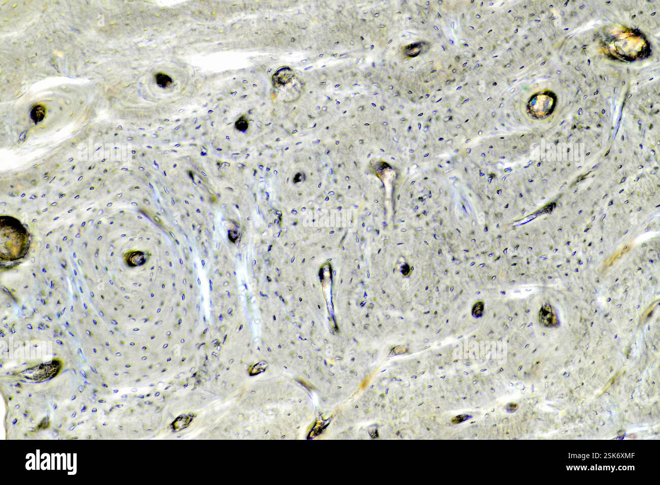 Osteocyte bone. Non-analysed polarised light micrograph of a transverse ...