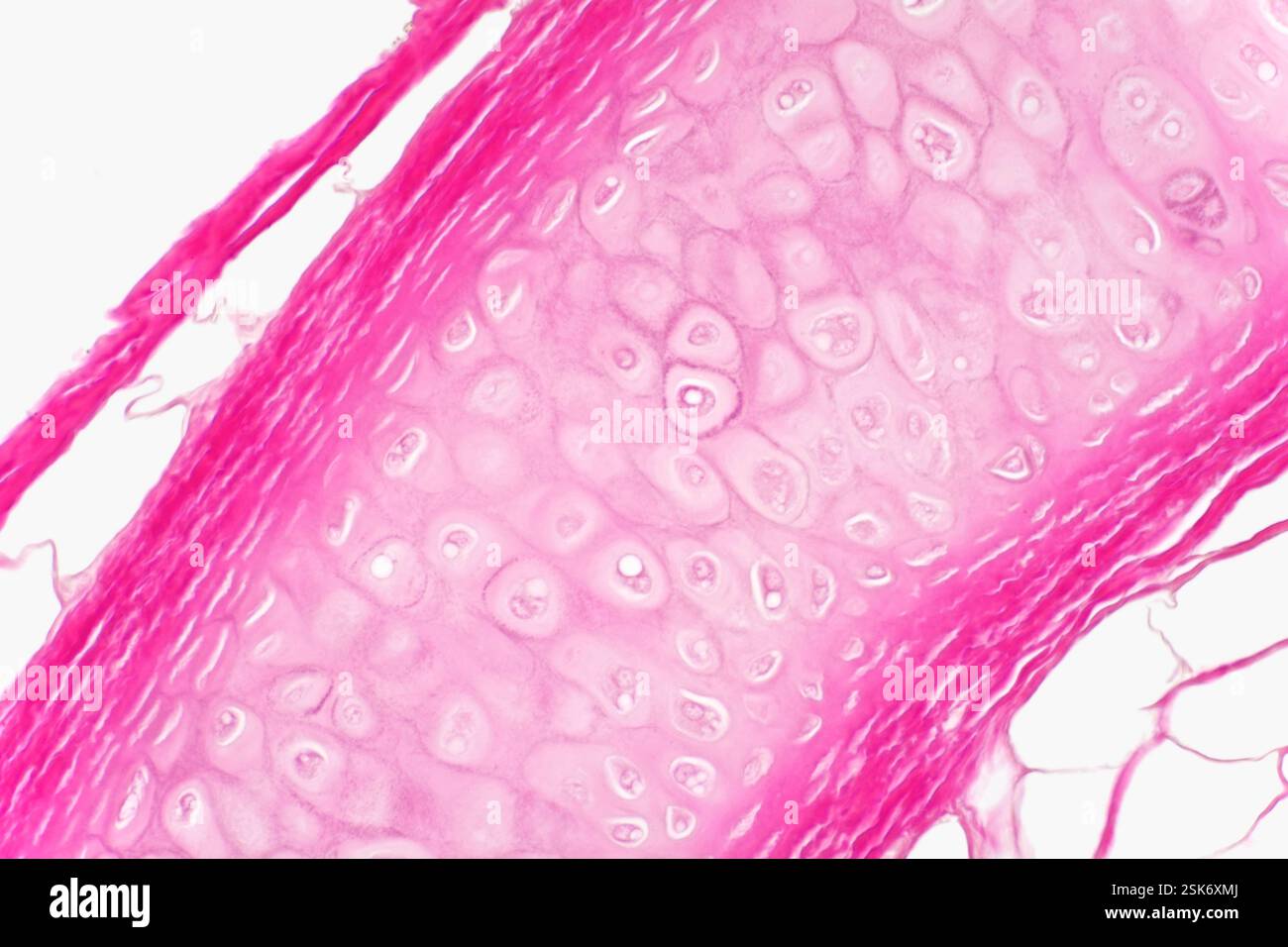 Hyaline cartilage. Light micrograph of a section through hyaline ...