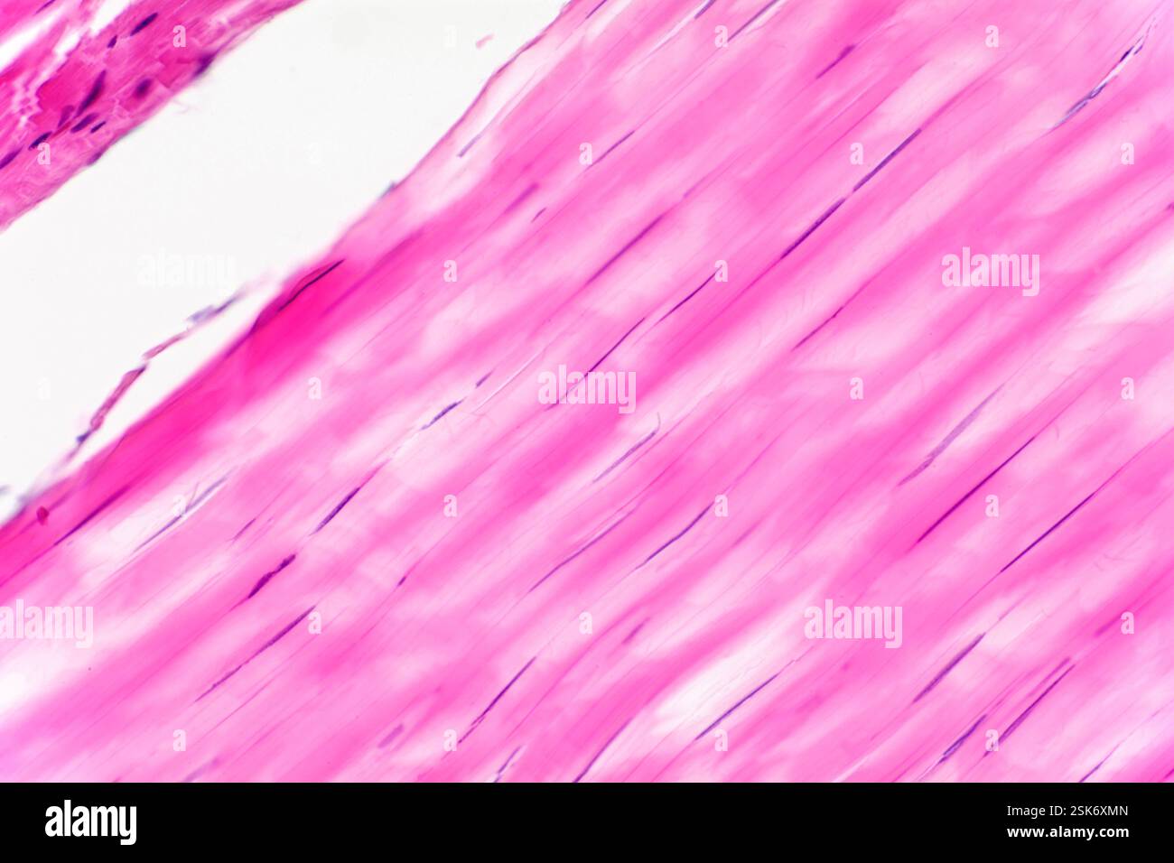 Tendon tissue. Light micrograph of a section through elastic connective ...