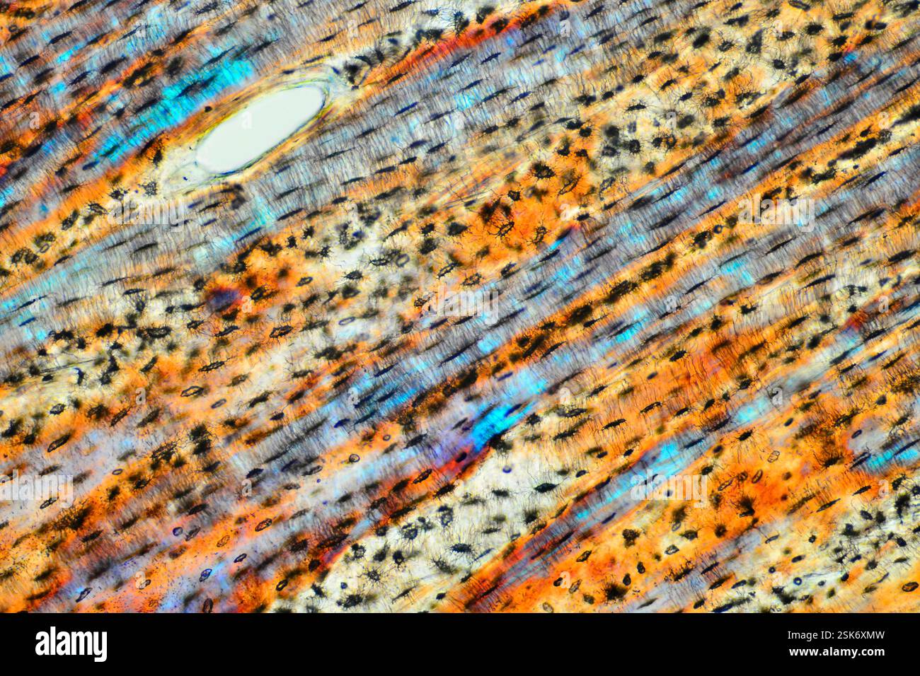 Osteocyte bone cells. Analysed polarised light micrograph of a ...