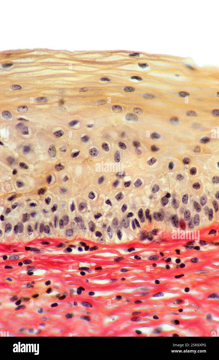 Human cervix. Light micrograph of a section through the epithelium of a ...