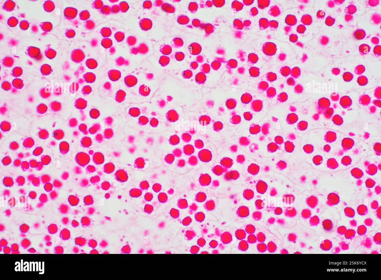 Castor bean aleurone grains. Light micrograph of aleurone grains in ...