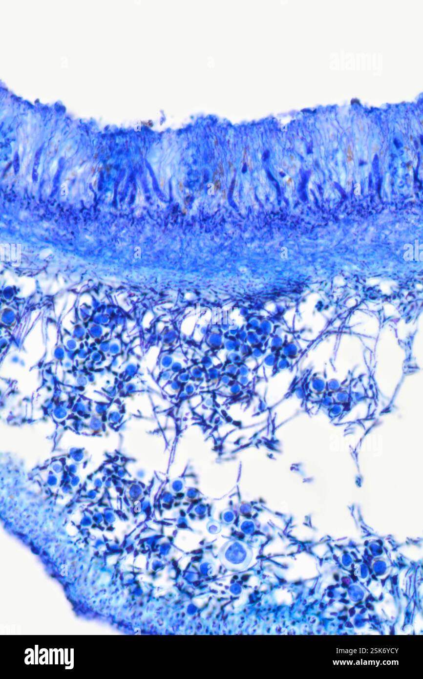 Fungal fruiting body in a lichen. Light micrograph of a section through ...