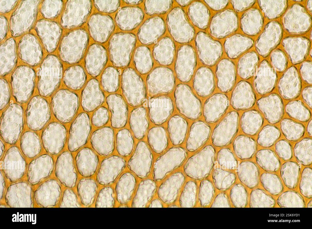 Chloroplasts in leaf cells. Light micrograph of chloroplasts in a leaf ...