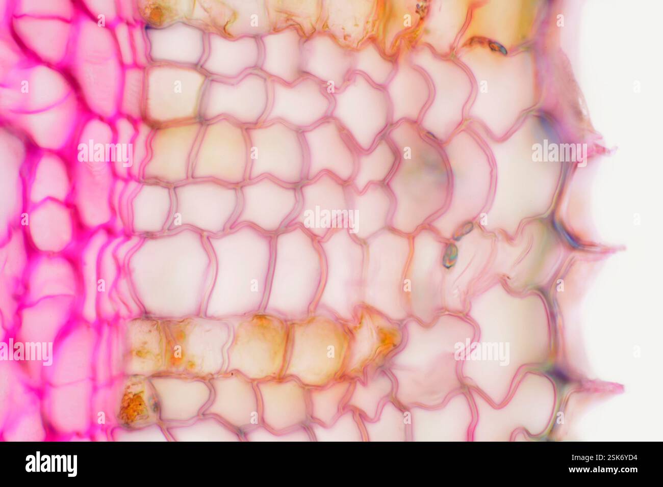 Elderberry stem tissue. Light micrograph of a cross-section though an ...