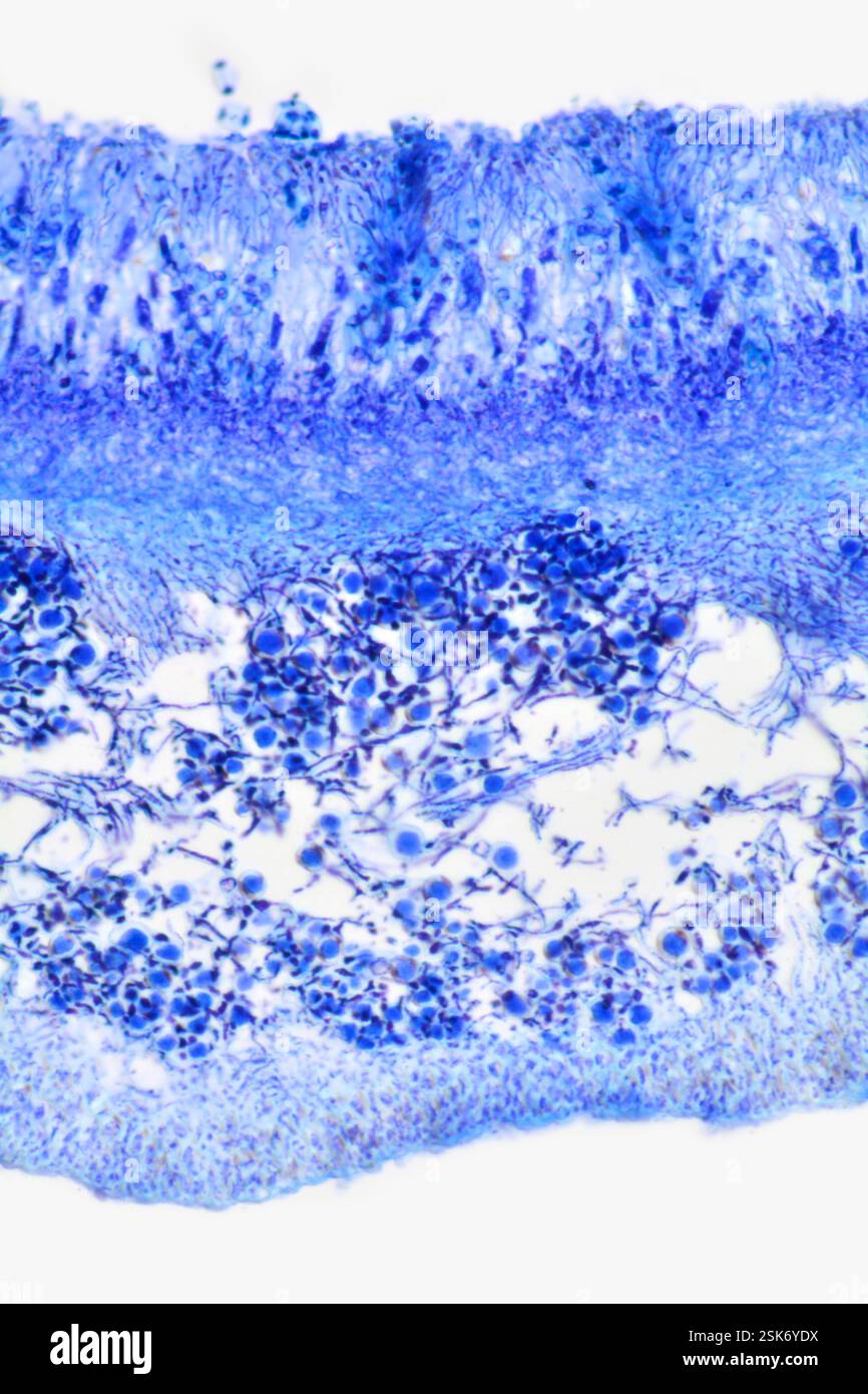Fungal fruiting body in a lichen. Light micrograph of a section through ...