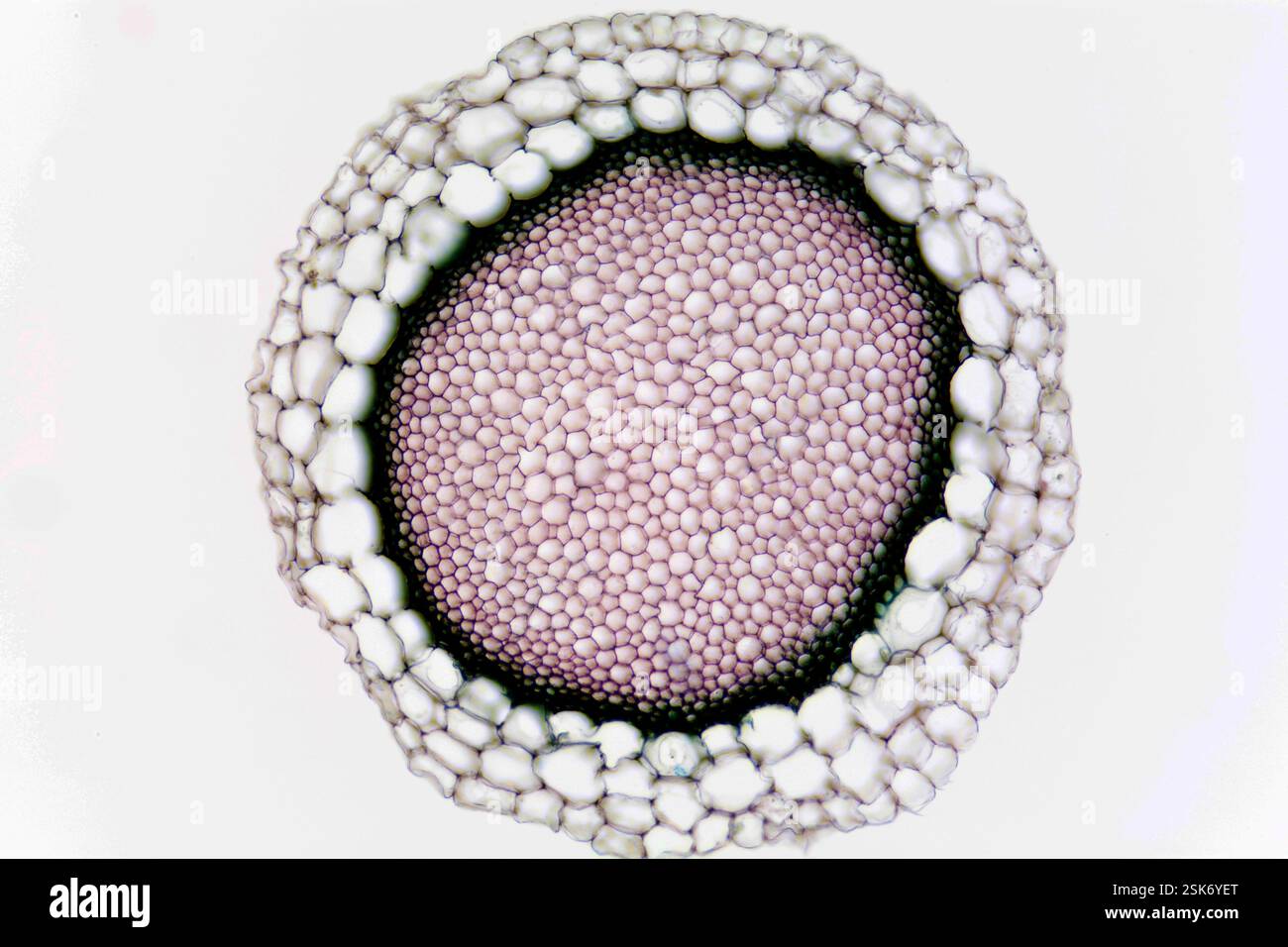 Moss stem cross-section. Light micrograph of a transverse section ...