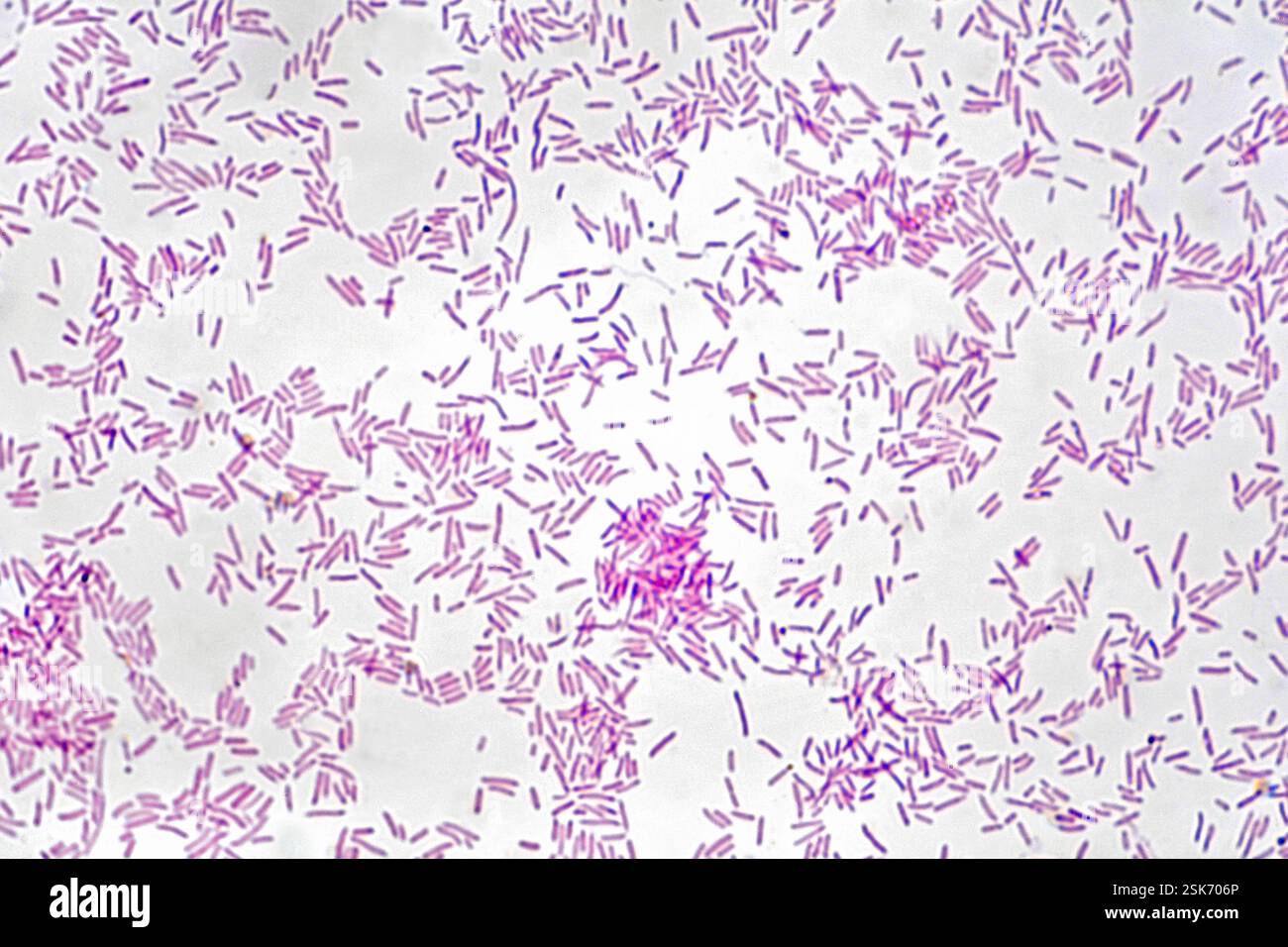 Typhoid bacteria. Light micrograph of a culture of Salmonella enterica ...