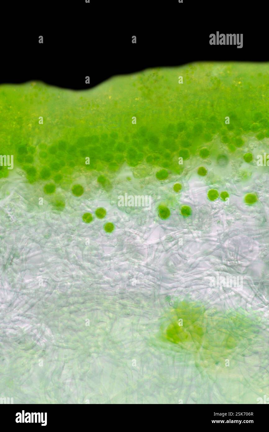 Lichen symbiosis. Light micrograph of unicellular algae (Chlorella ...