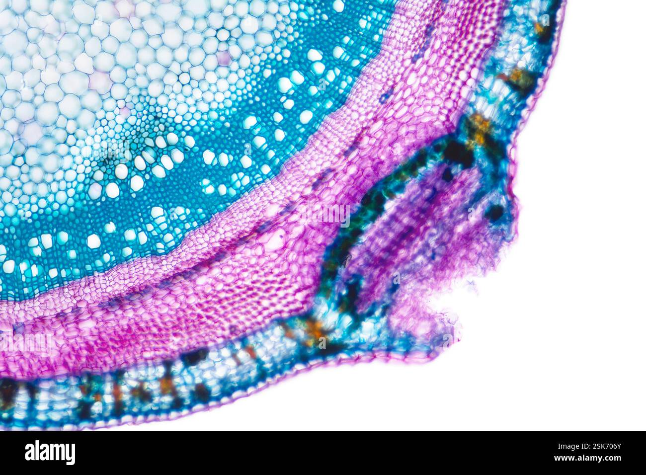 Lenticel on a plant stem. Light micrograph of a cross-section through ...