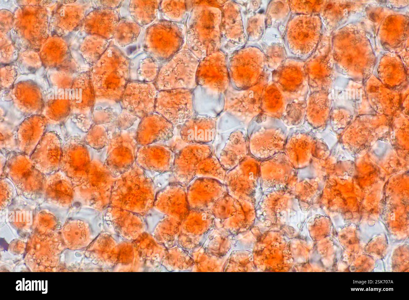 Lipid cells from a nut, light micrograph. Lipids (which include oils ...