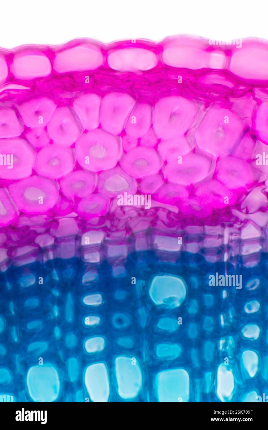 Pine stem cross-section. Light micrograph of cellulosic fibres seen in ...