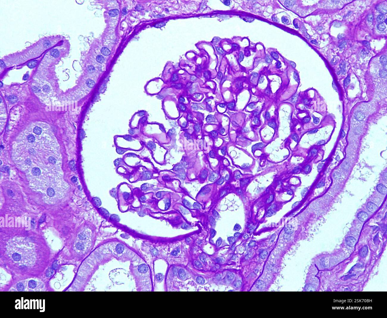 Healthy kidney glomerulus. Light micrograph of a section through a ...