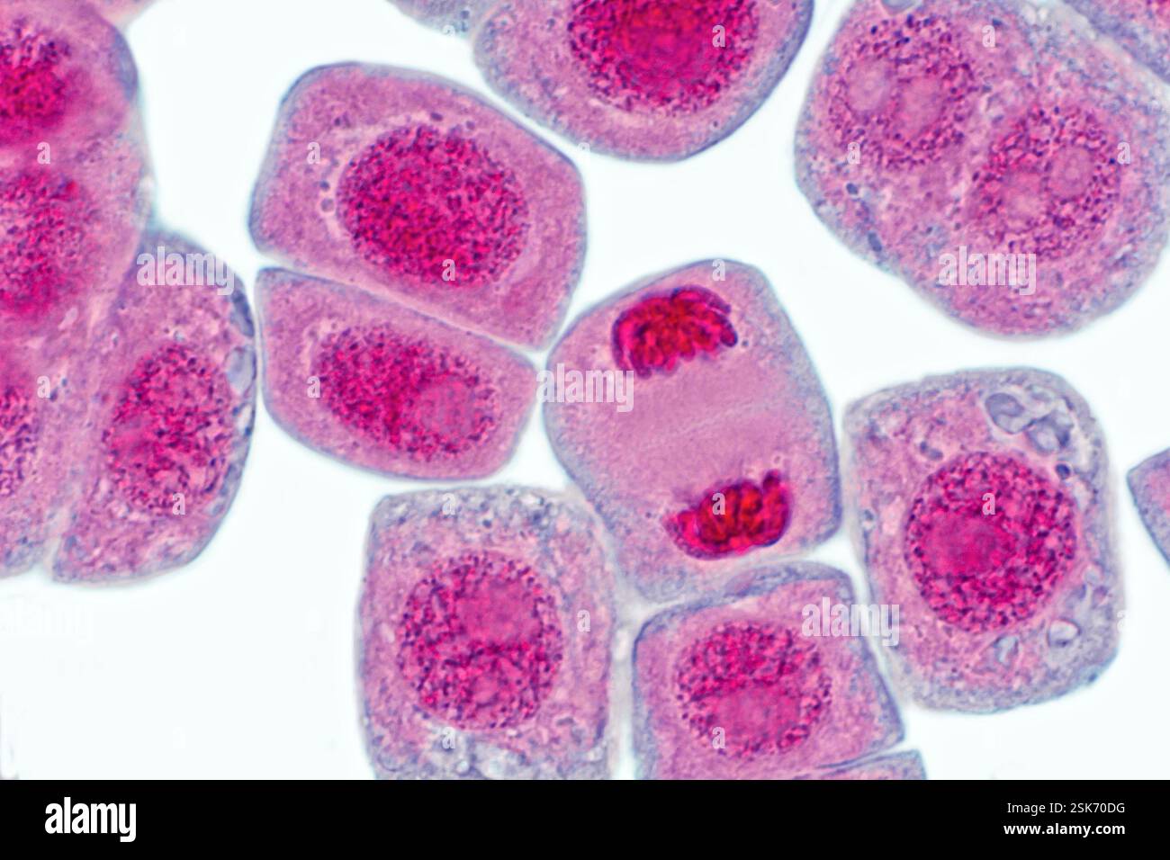 Mitosis in plant root. Light micrograph showing dissociated ...