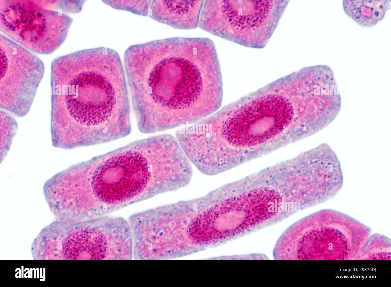 Mitosis in plant root. Light micrograph showing dissociated ...