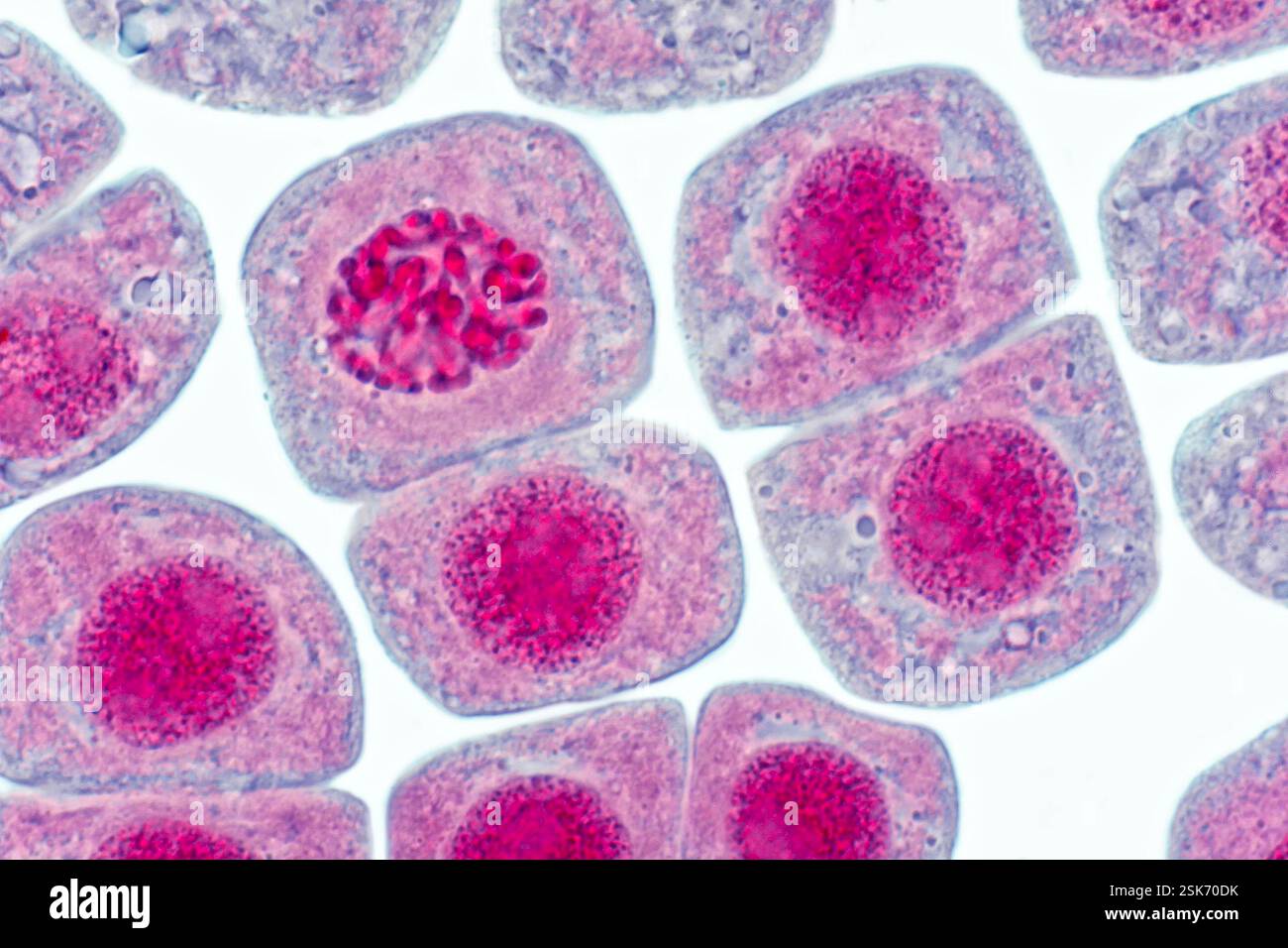Mitosis in plant root. Light micrograph showing dissociated ...