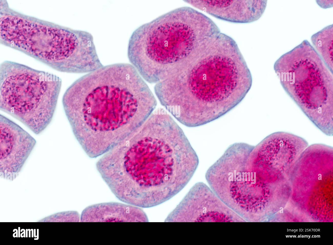 Mitosis in plant root. Light micrograph showing dissociated ...