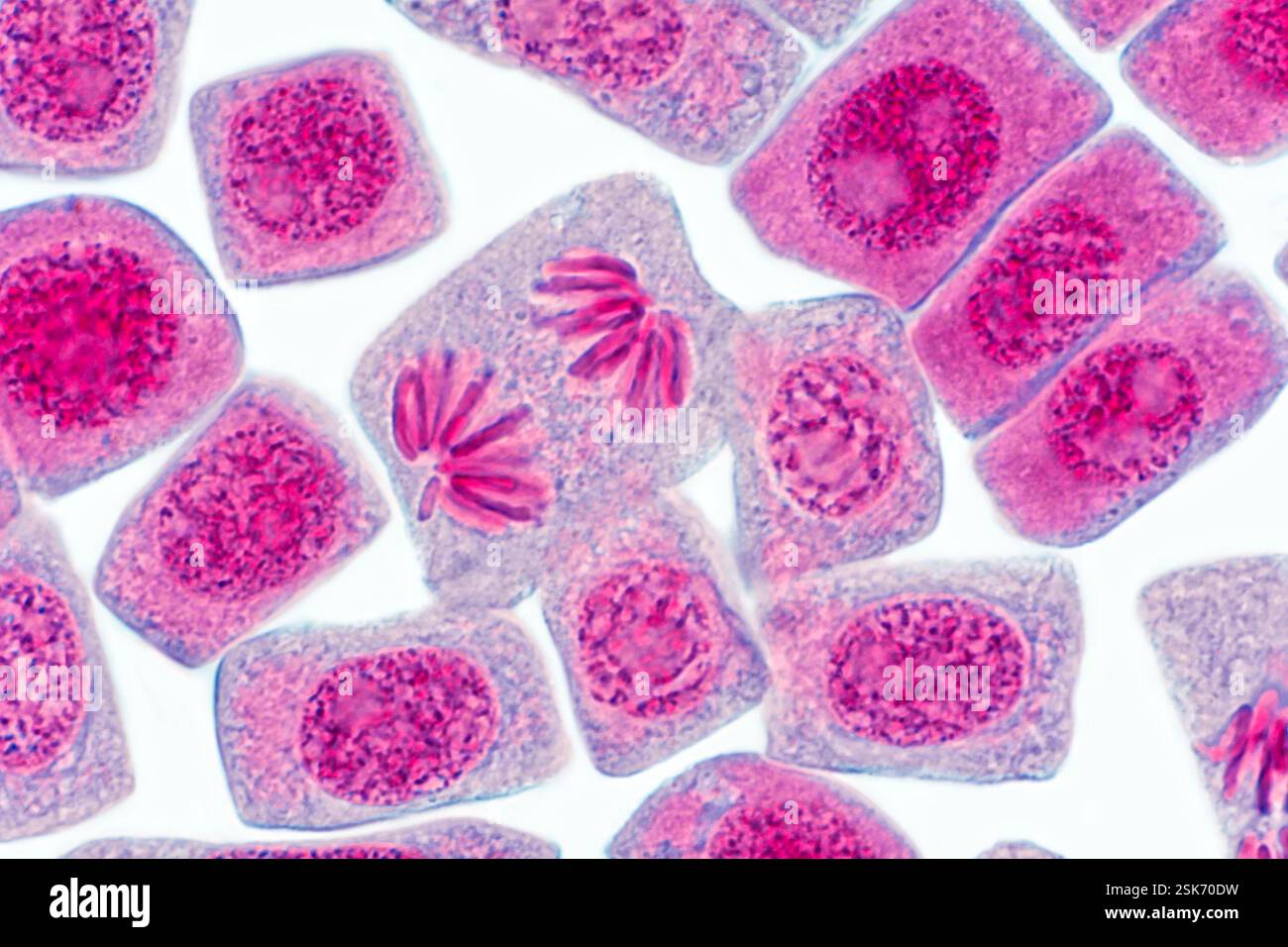 Mitosis in plant root. Light micrograph showing dissociated ...