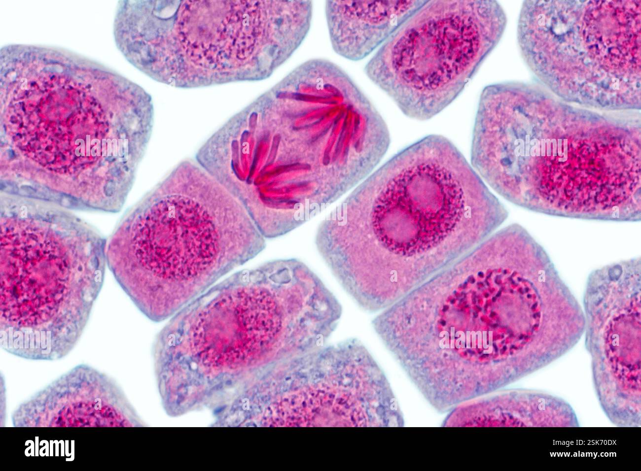 Mitosis in plant root. Light micrograph showing dissociated ...