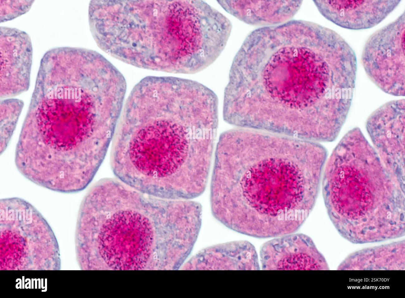 Mitosis in plant root. Light micrograph showing dissociated ...