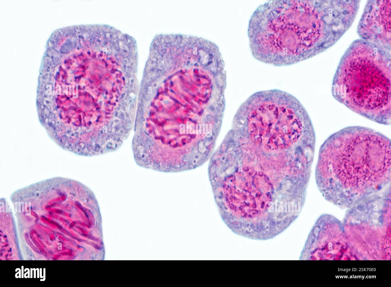 Mitosis in plant root. Light micrograph showing dissociated ...