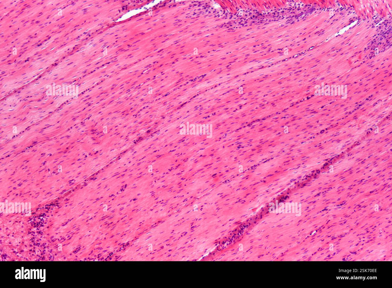 Smooth muscle tissue. Light micrograph of a longitudinal section ...