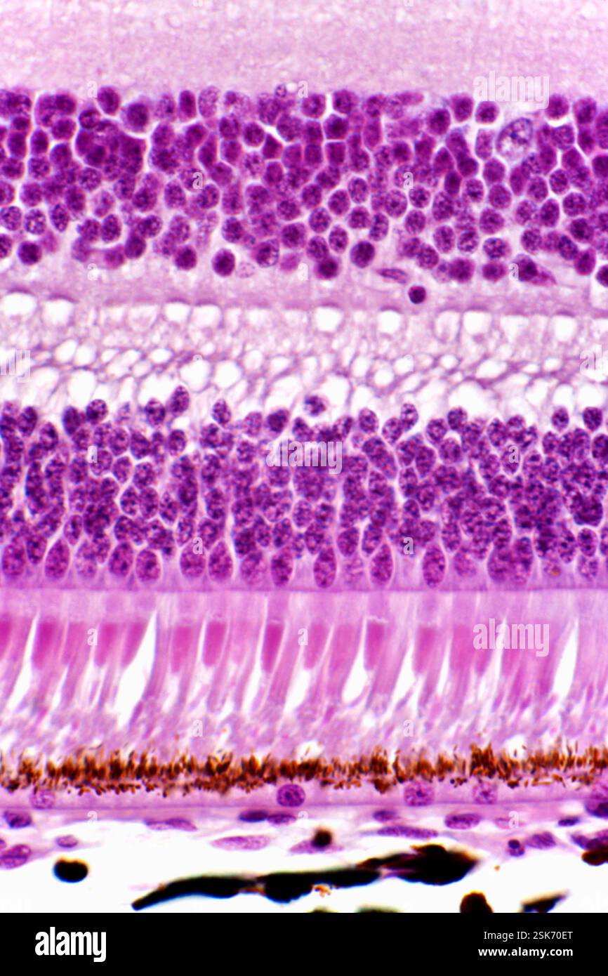 Retina layers. Light micrograph of a section through layers of the ...