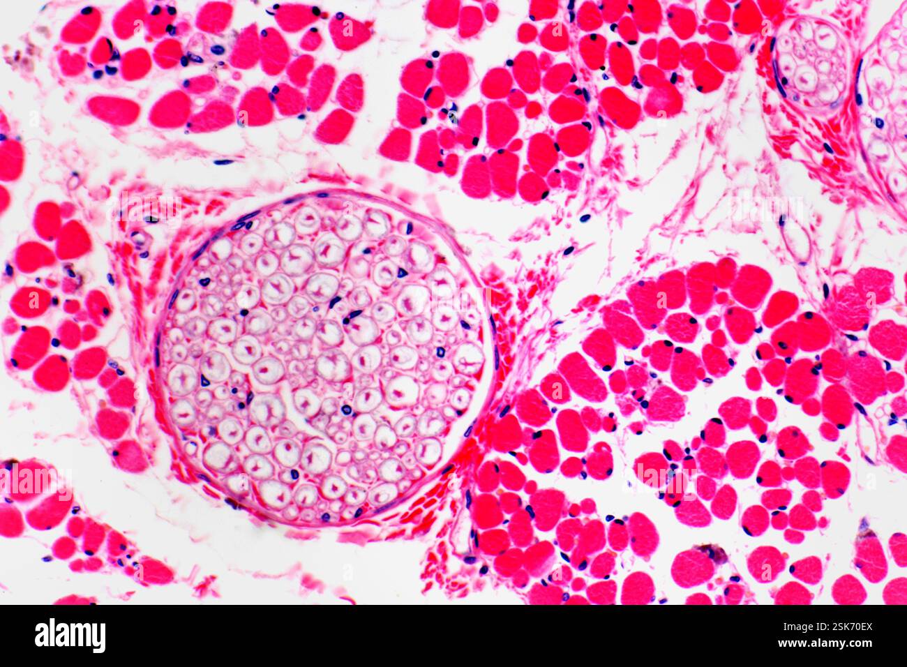 Nerve in muscle. Light micrograph of a cross-section through striated ...