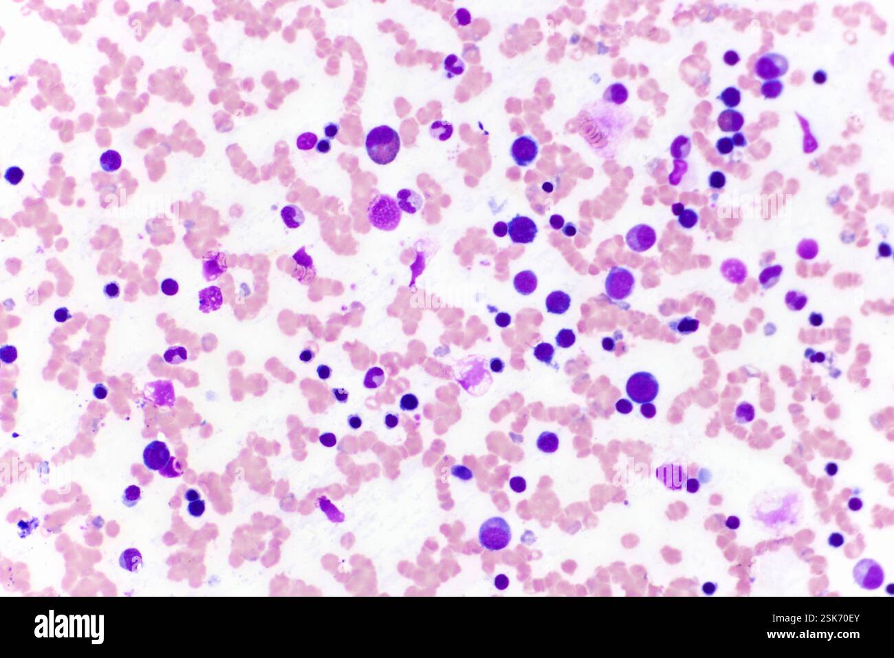 Bone marrow blood cells, light micrograph. Bone marrow is one of the ...