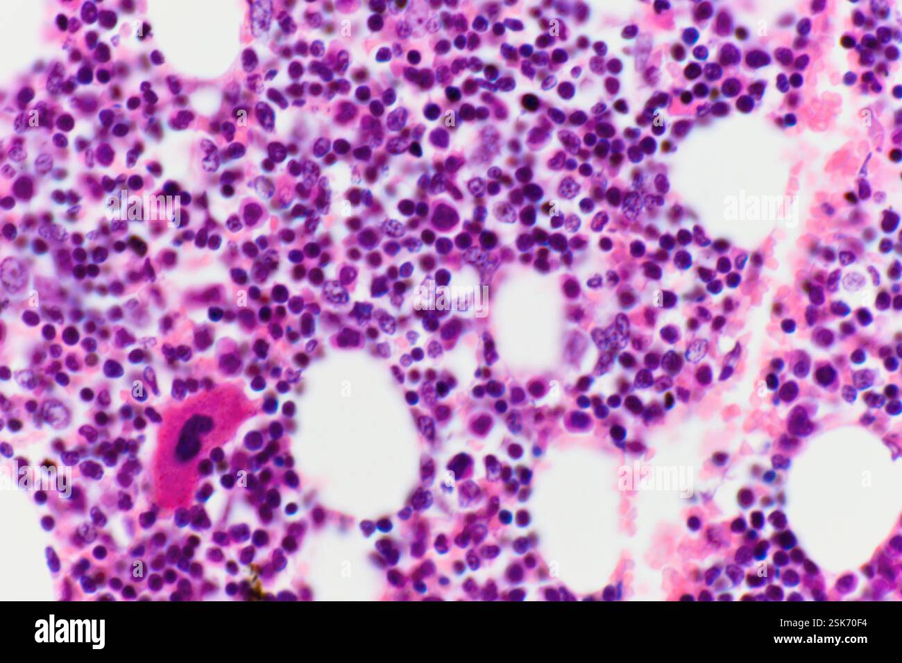 Bone marrow. Light micrograph of a section through a sample of bone ...