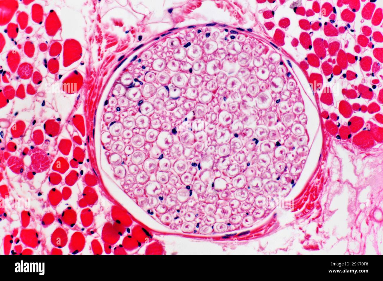 Nerve in muscle. Light micrograph of a cross-section through striated ...