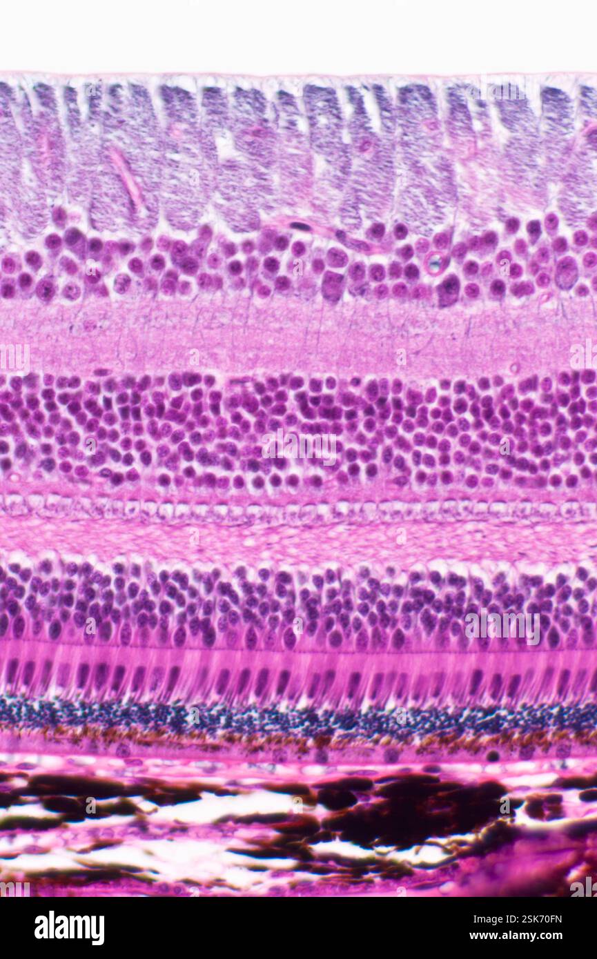 Retina layers. Light micrograph of a section through layers of the ...