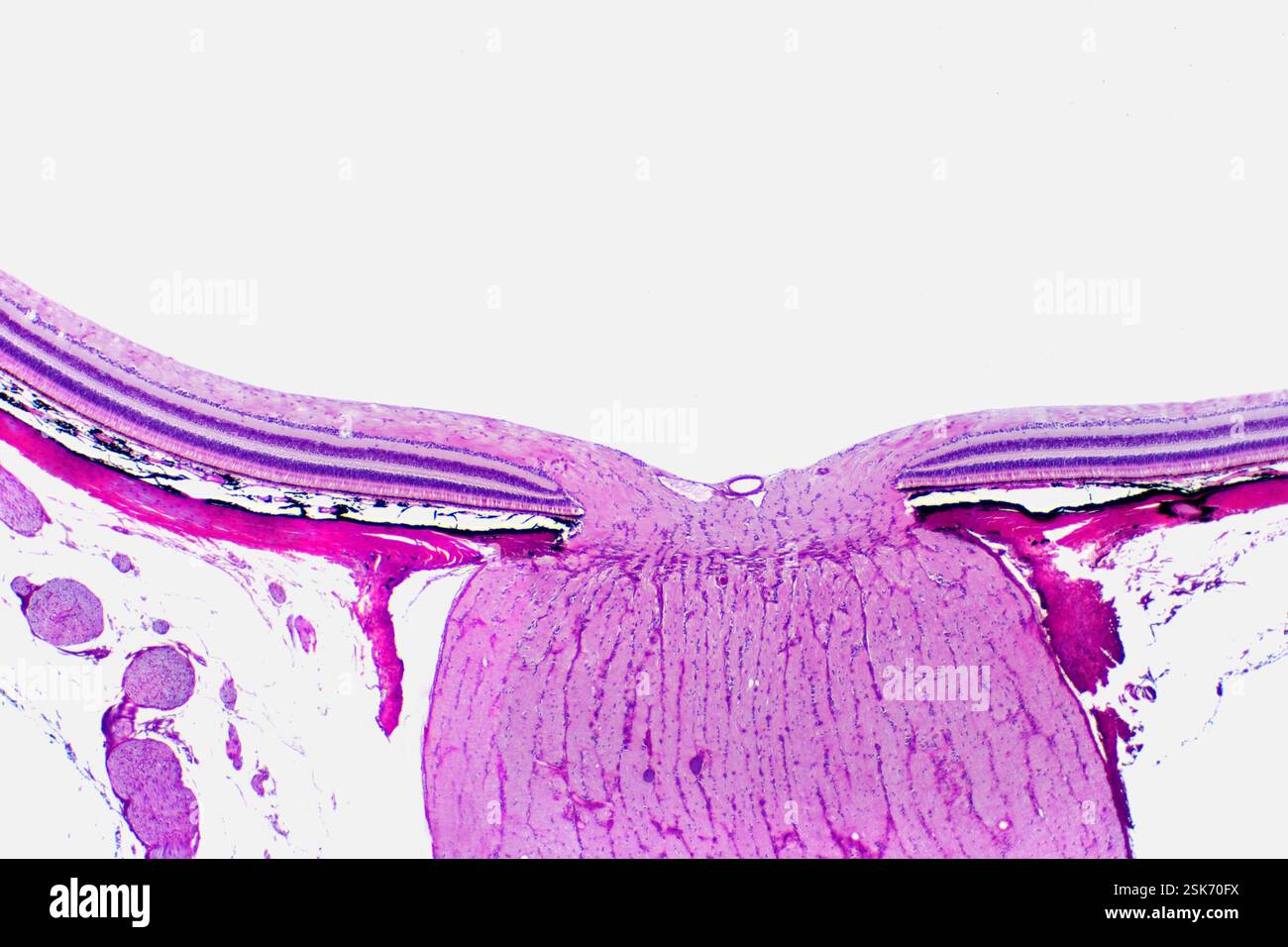 Optic nerve papilla. Light micrograph of a section through the retina ...