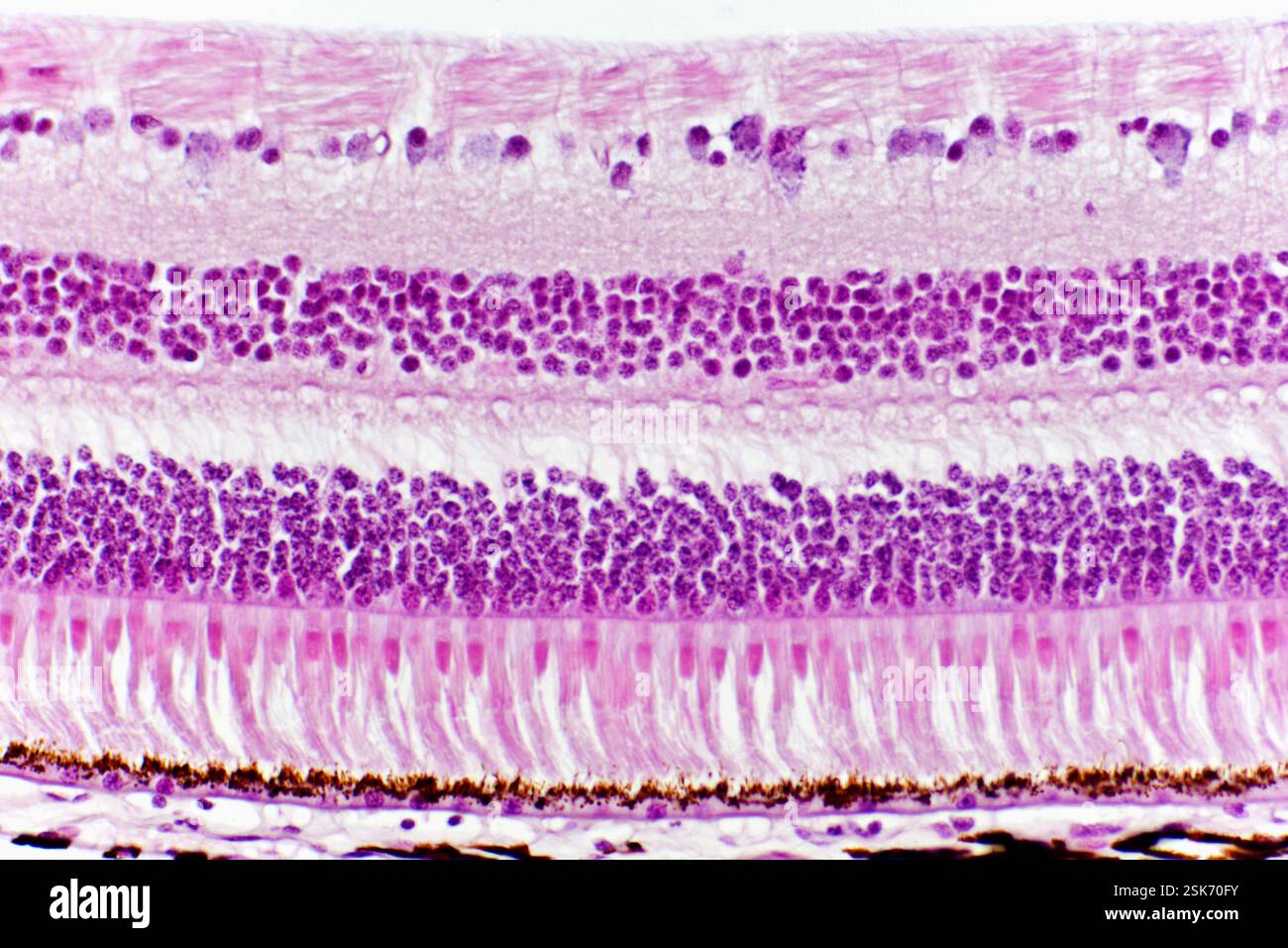 Retina layers. Light micrograph of a section through layers of the ...