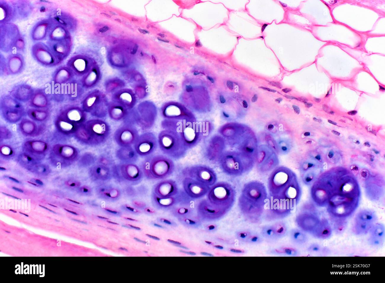 Hyaline cartilage. Light micrograph of a section through hyaline ...