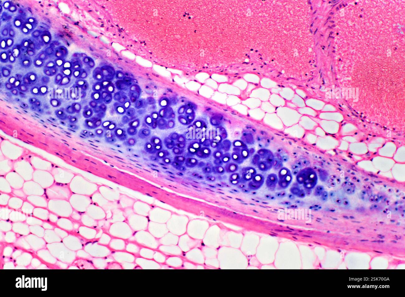 Hyaline cartilage. Light micrograph of a section through hyaline ...