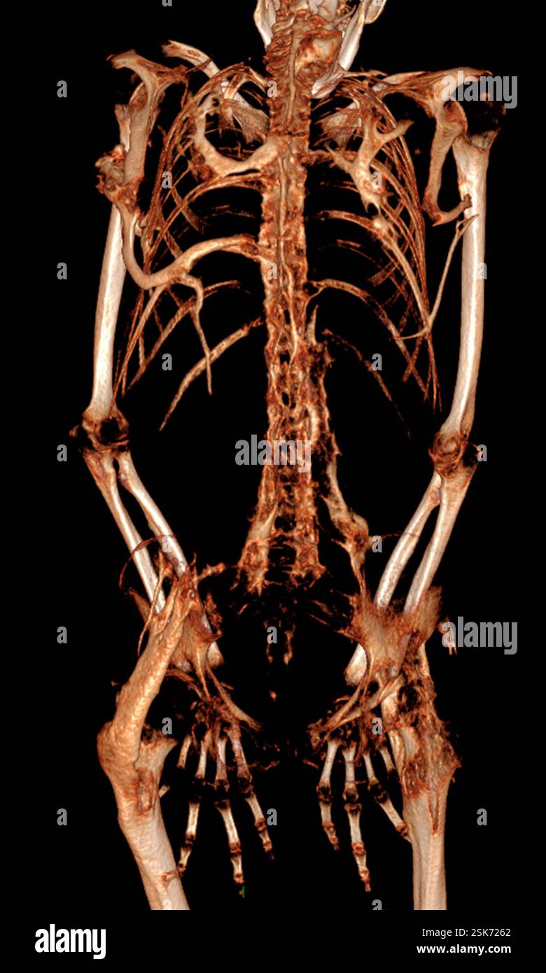 Photodermatitis on a woman's face Stock Photo - Alamy