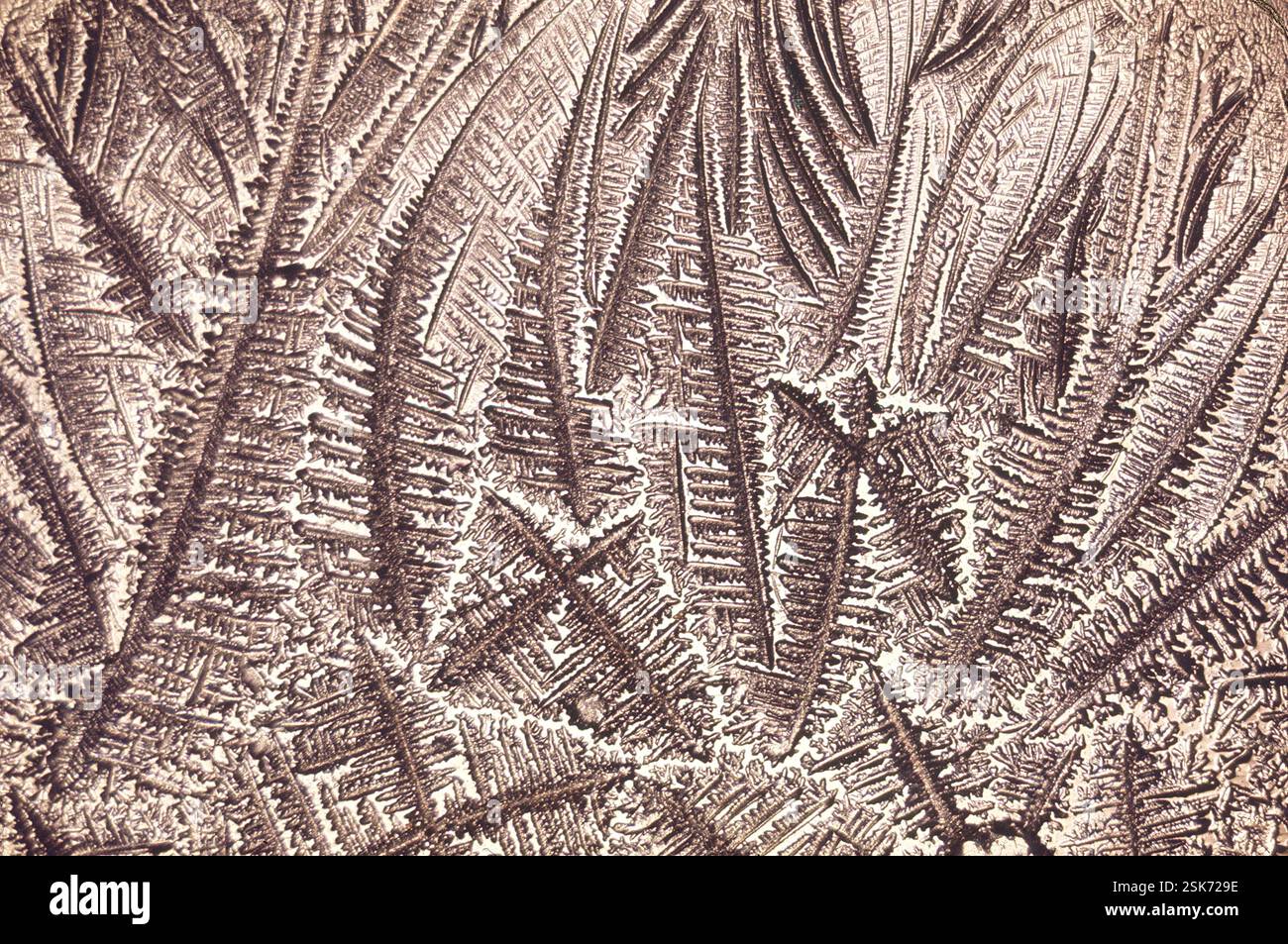 Positive cervical mucus fern test, light micrograph. The cervical mucus ...