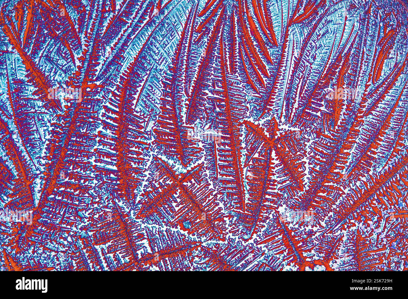 Positive cervical mucus fern test, light micrograph. The cervical mucus ...